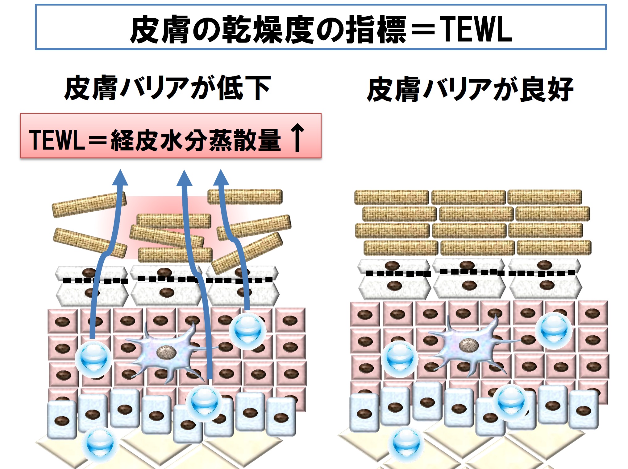 TEWL(経皮水分蒸散量)を小児アレルギー専門医が解説してみた。